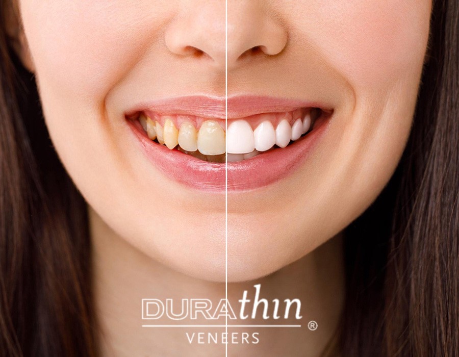 Dental Treatments | Bangkok Dental, Dentist by Bangkok Smile Dental ...